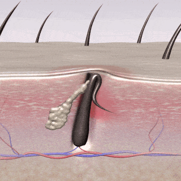 FLEX™ Pro Vibrating Face Brush